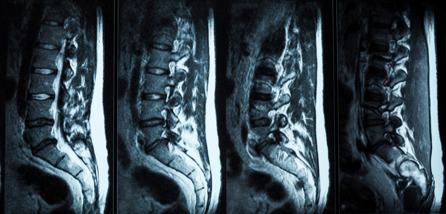 Imaging Center | Greater Birmingham, AL - Blue Lake Open MRI